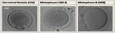 Oocyte Grading - Reviva IVF